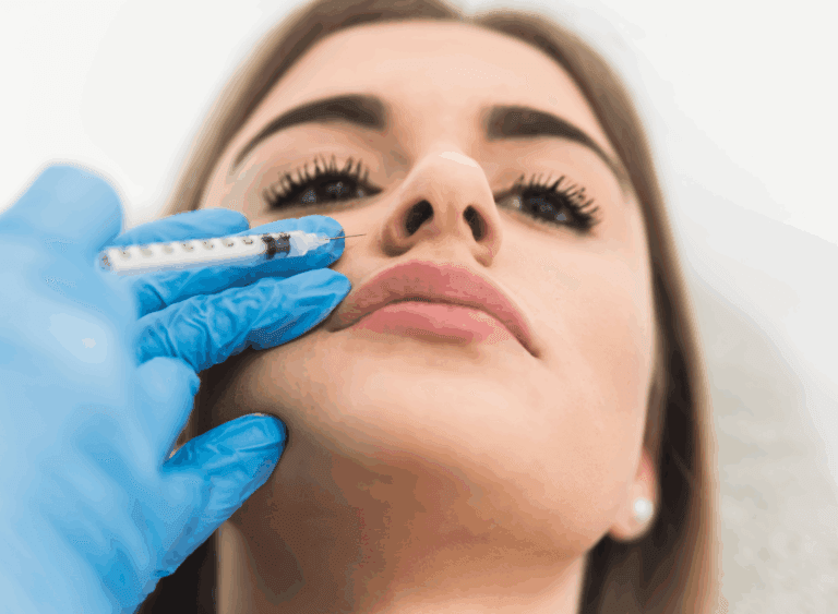 Gummy Smile Botox | Botox | AuraDent, Nicosia, Cyprus